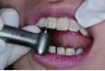 GC Aligner Connect | GC Ortho